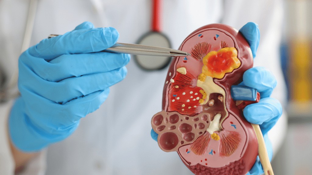 Urologiese toestelle