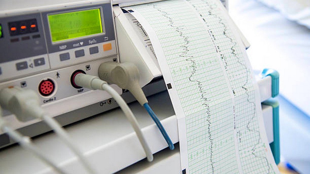 Ctg (Cardiotocography) උපාංගය