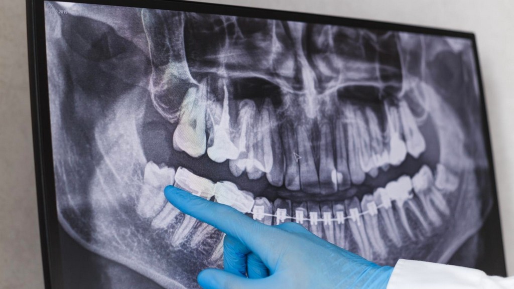 Dispositivos de rayos X dentales