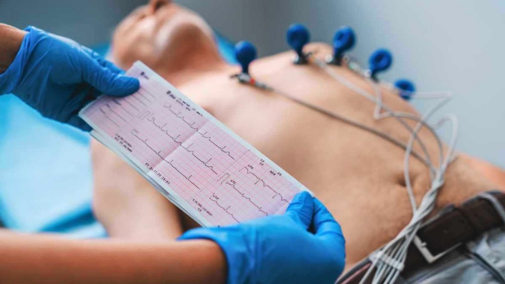 Electrocardiography (ECG) Electrodes
