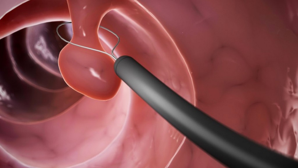 Colonoscopio flexible