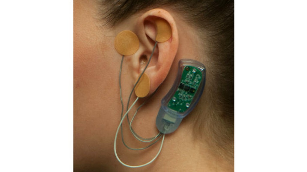 Dispositivos de neuroestimulación implantables