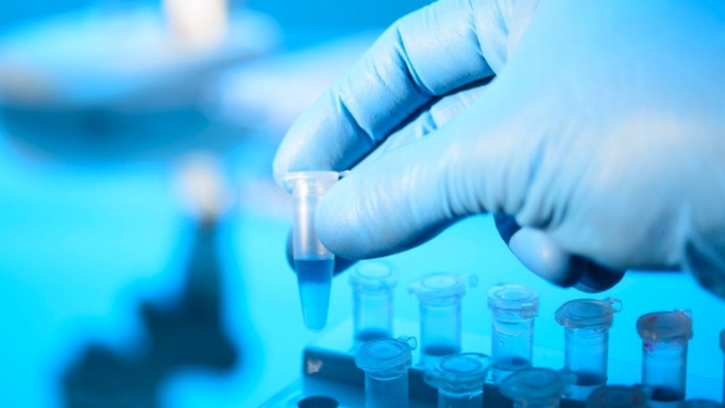 Column Based DNA Extraction Kits