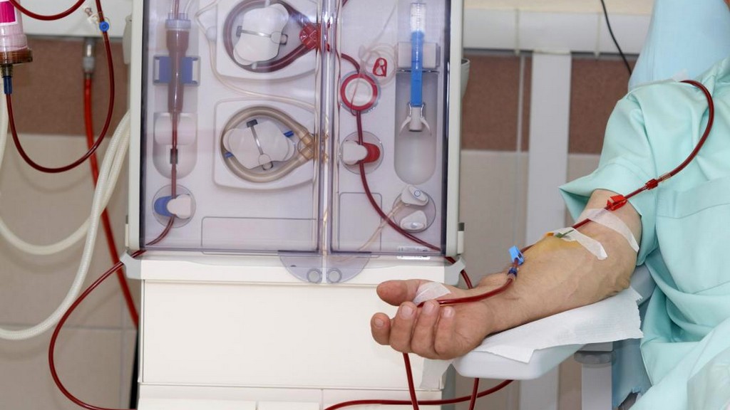 Conventional Hemodialysis Machines