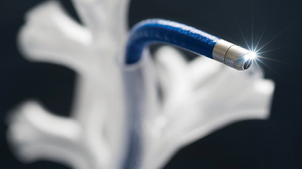 Gastroscopio de retroflexión