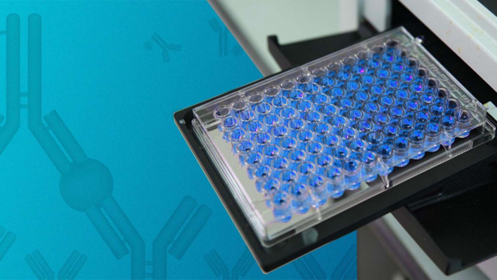 Robotic Microplate Loader