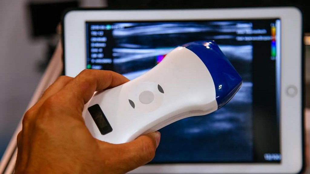 Dispositivos de ultrasonido portátiles