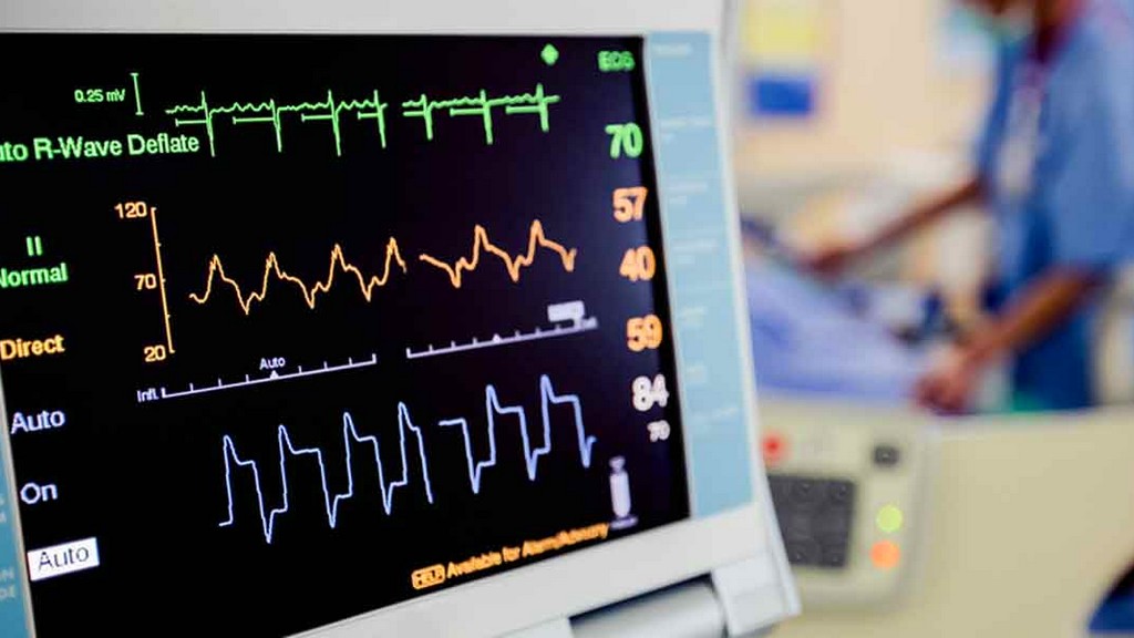 Monitor EKG Bayi Baru Lahir